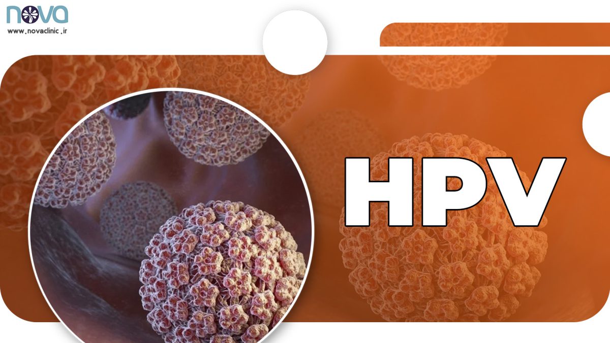 عفونت HPV چیست و چگونه به وجود می آید؟ (پارت اول) - نووا کلینیک